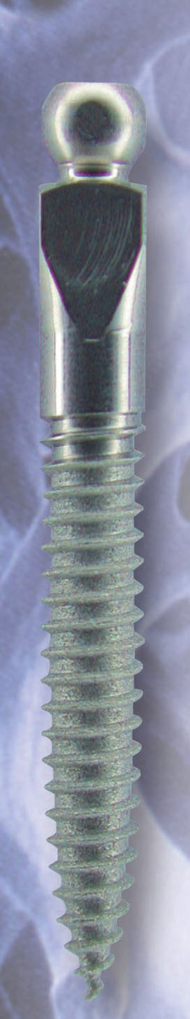 Hi-Tec Implants TRI Implant dentaire | SpotImplant