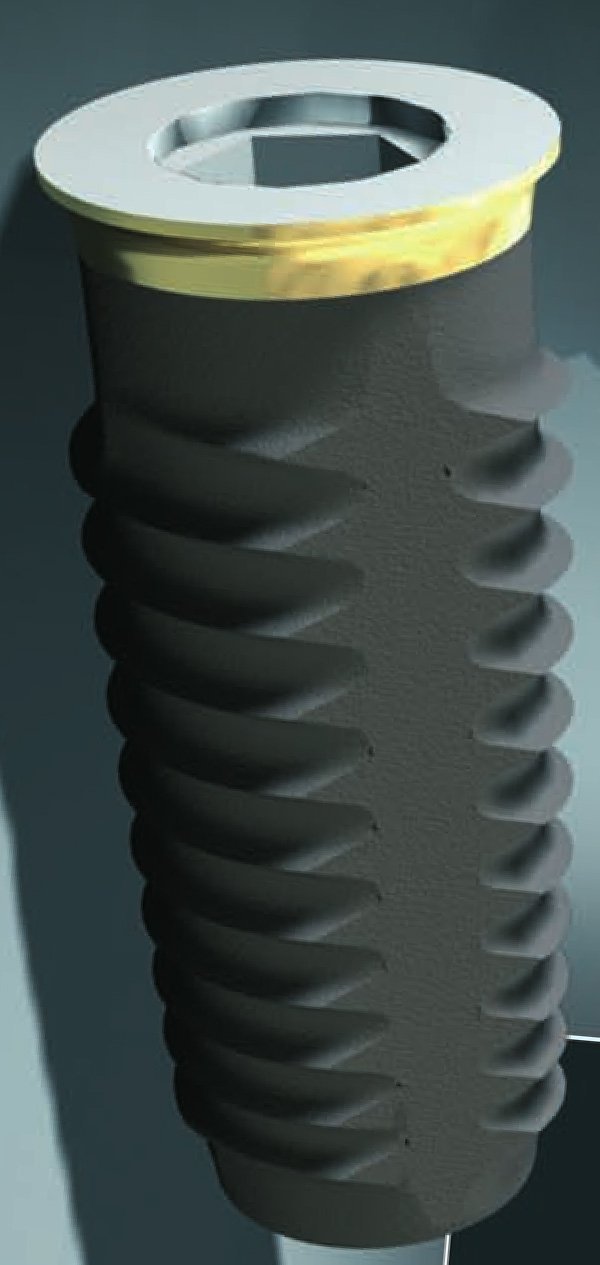 IDI Dental ID Max Implante dentário | SpotImplant