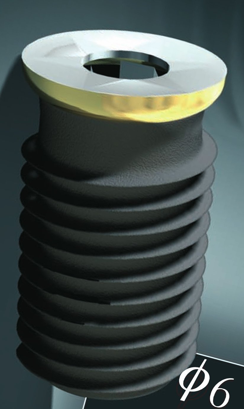 IDI Dental ITP Gold Dental Implant | SpotImplant