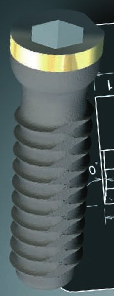 IDI Dental ITP Gold Dental Implant | SpotImplant