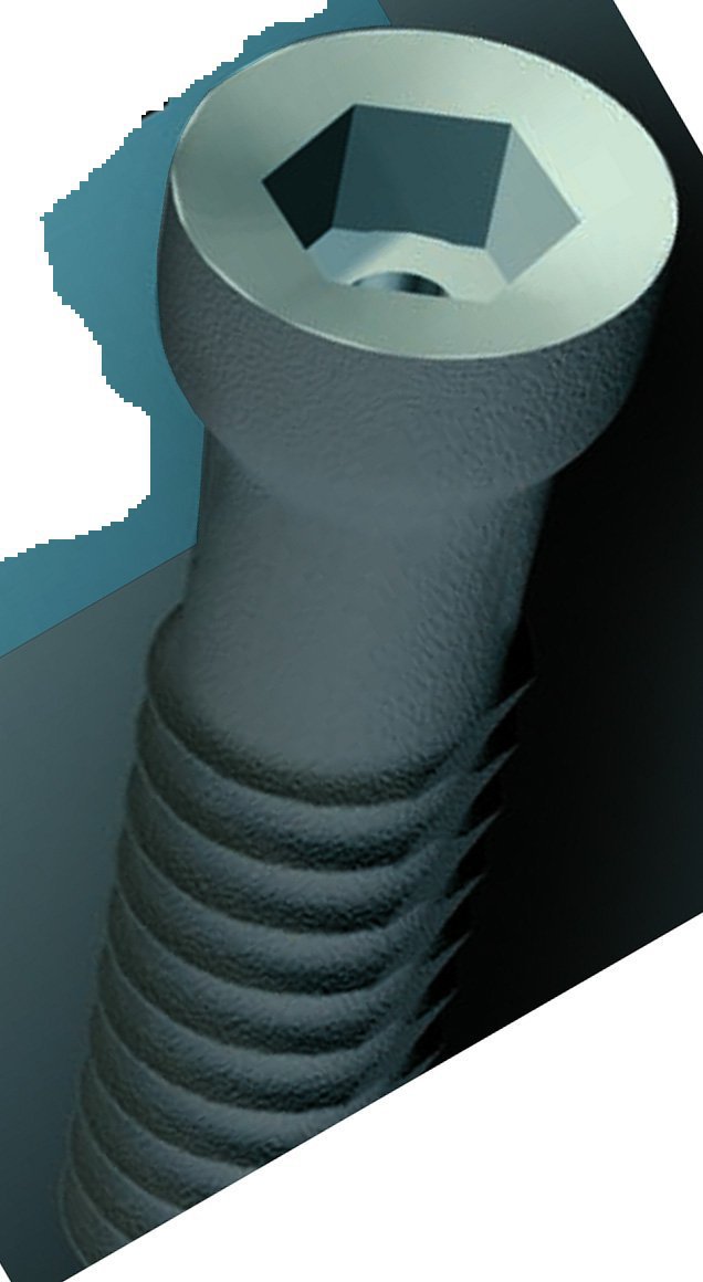 IDI Dental ONB Implant dentaire | SpotImplant
