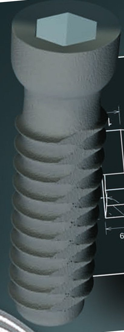 IDI Dental ONB Implant dentaire | SpotImplant