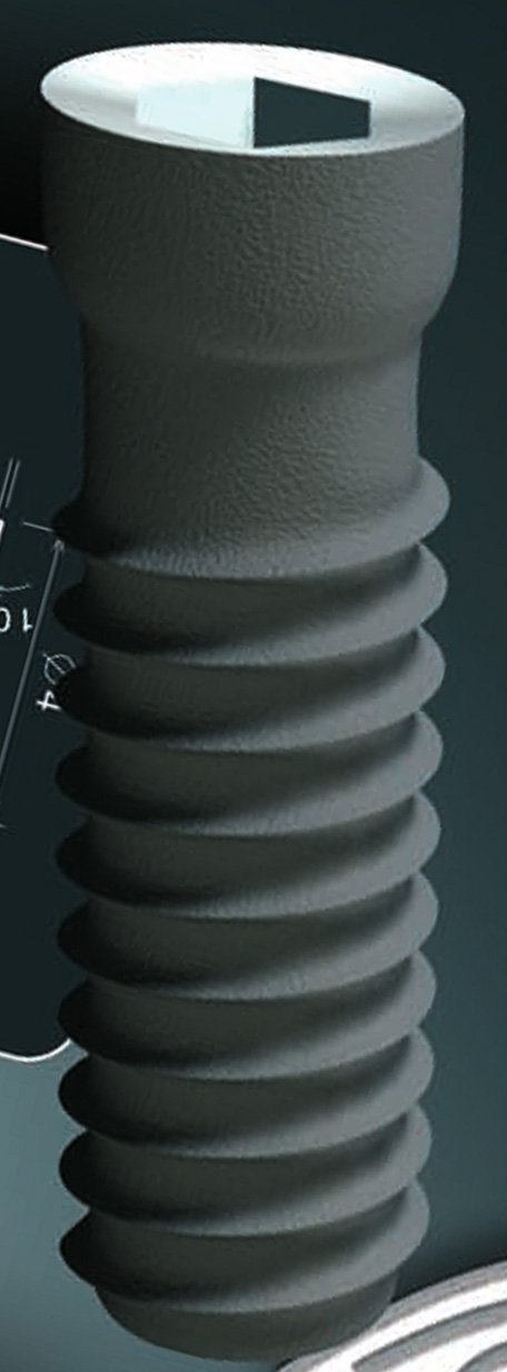 IDI Dental ONB Implant dentaire | SpotImplant