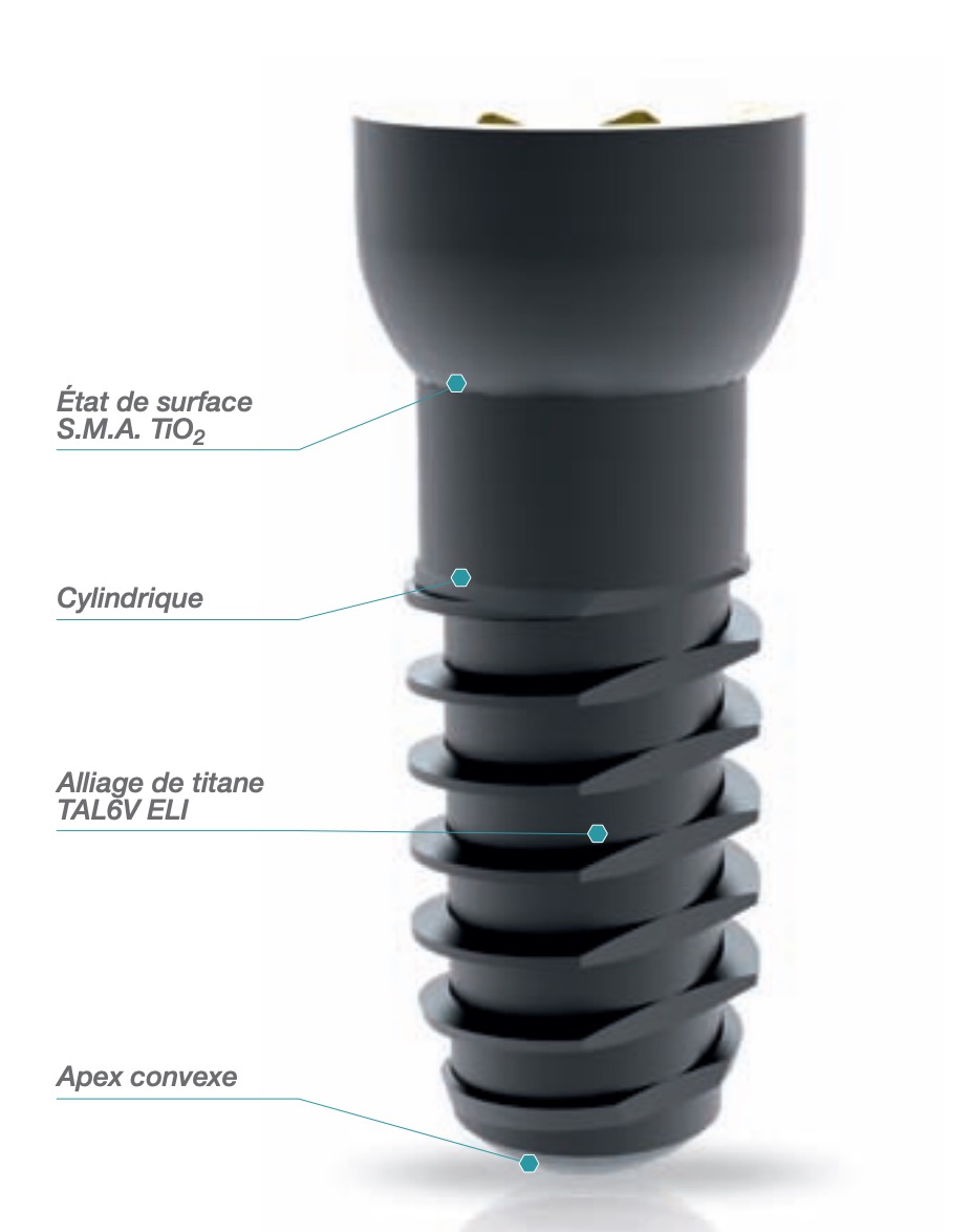 IDI Dental ONB Implant dentaire | SpotImplant