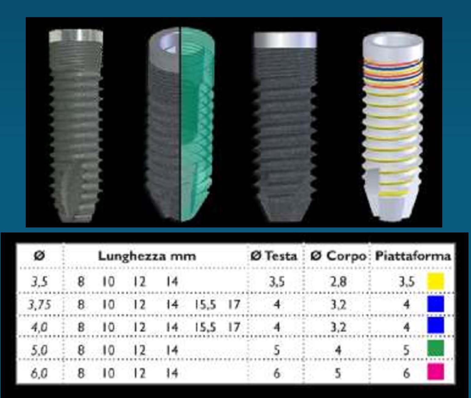 IDI Evolution Stone Dental Implant | SpotImplant