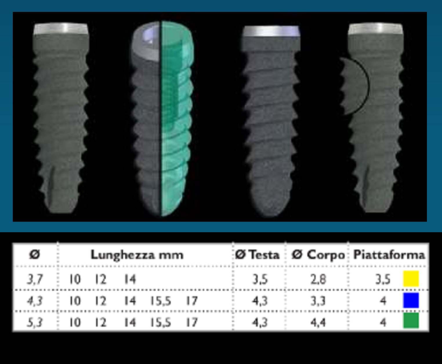 IDI Evolution Tank Dental Implant | SpotImplant