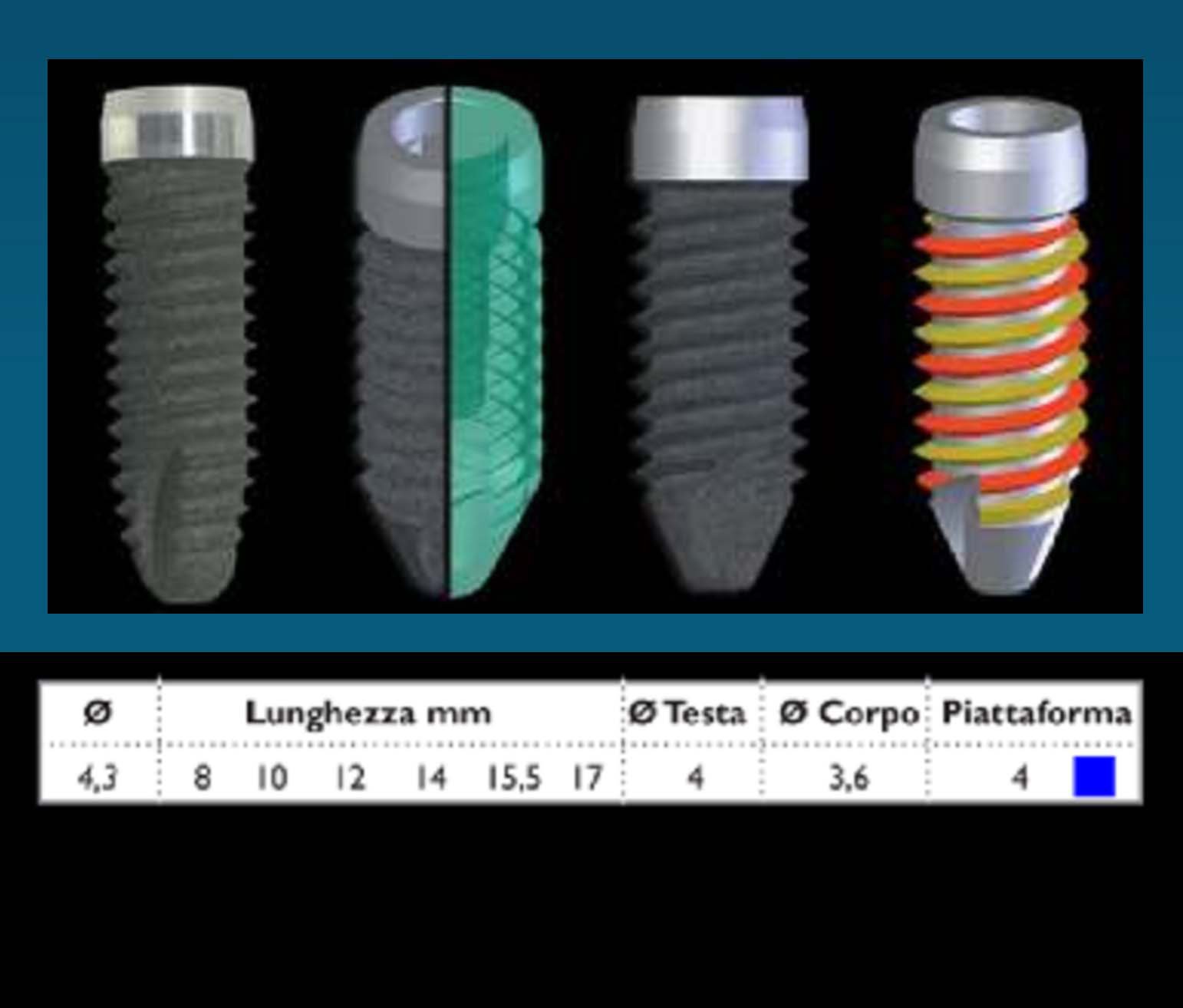 IDI Evolution Tiger Dental Implant | SpotImplant