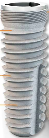 Medentika Procone Dental Implant | SpotImplant