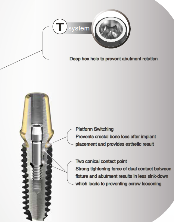 IZEN ZENEX T-System Implante dental | SpotImplant