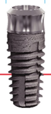 Implantswiss Tissue Level (4.8 Straight head) Dental Implant | SpotImplant