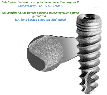 Safe Implant Surcam Shark Dental Implant | SpotImplant