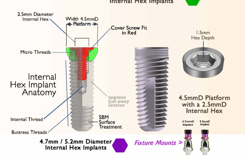 ITL Dental Internal Hex (NP) Dental Implant | SpotImplant