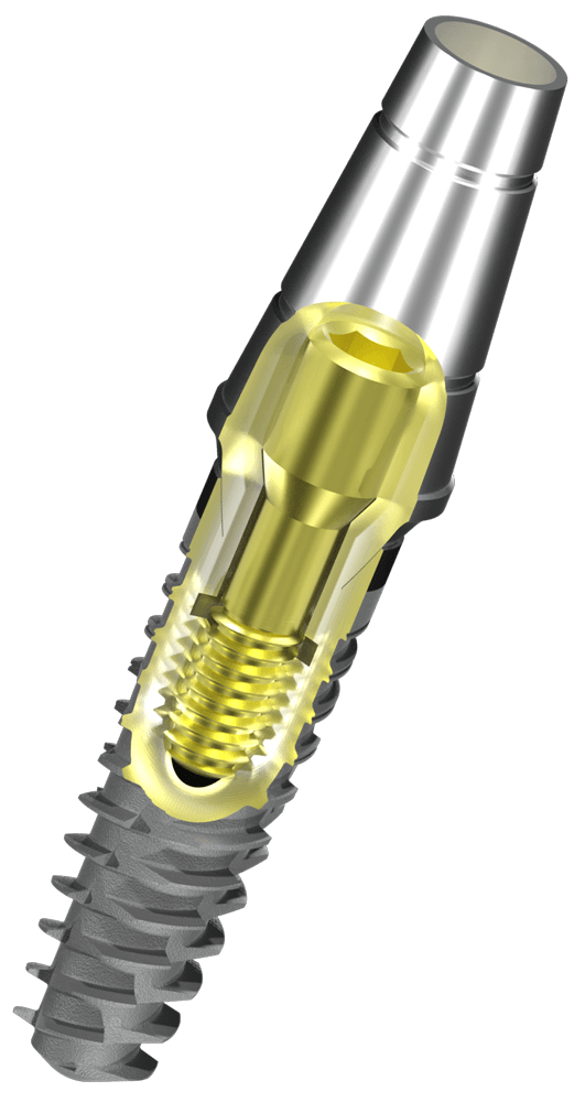 Radix (Proekcia Ltd.) Balance Dental Implant | SpotImplant