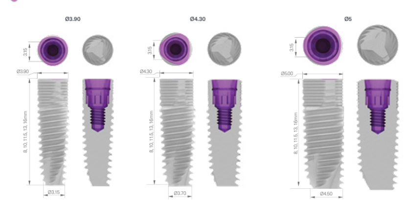 MIS V3 conical connection Implant dentaire | SpotImplant