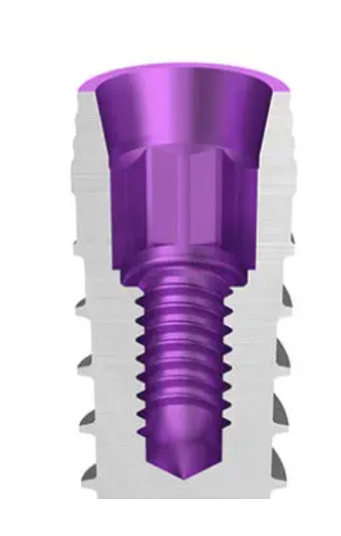 Klockner Vega Dental Implant | SpotImplant