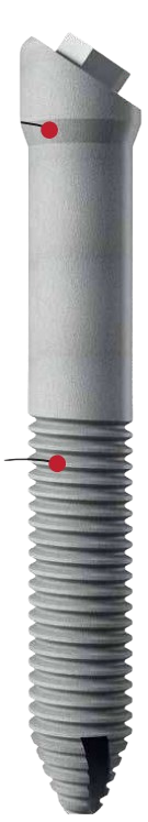 Kamal i-Fix Zygon Implant dentaire | SpotImplant