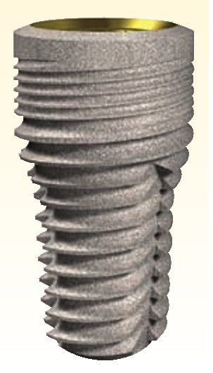 Implant Direct Legacy 2 Implant dentaire | SpotImplant