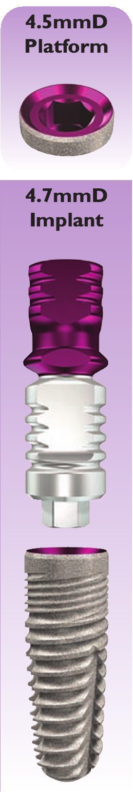 Implant Direct Legacy 2 Implant dentaire | SpotImplant