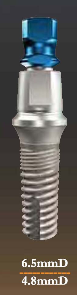Implant Direct SwissPlant (SX-Plant) Dental Implant | SpotImplant