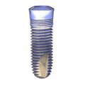 Intra-Lock System International Wide Platform Straight Body Implant ...