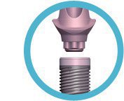 Keystone Dental (Lifecore Biomedical) Genesis Straight Implante dental ...