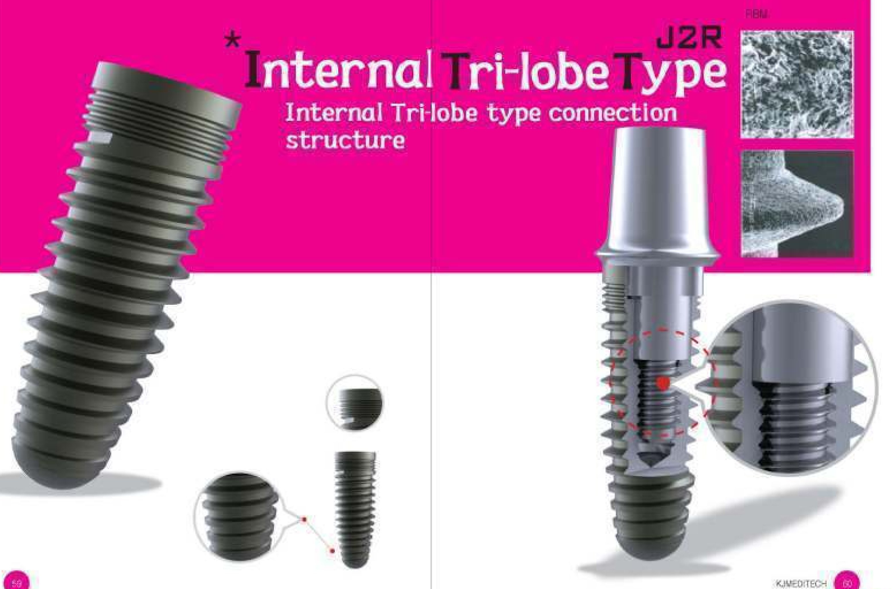 KJ Meditech J2R Dental Implant | SpotImplant