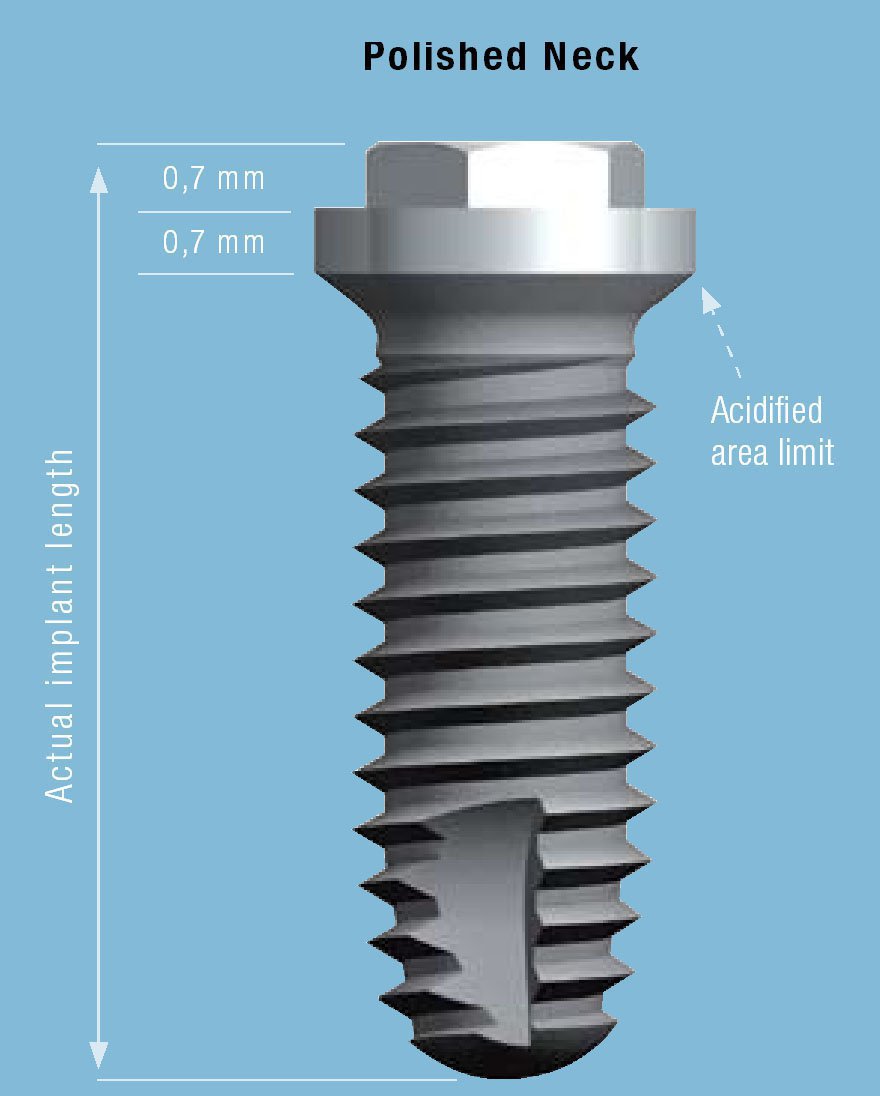 Leader Italia Implus Cylindrical (External Hex) Dental Implant ...