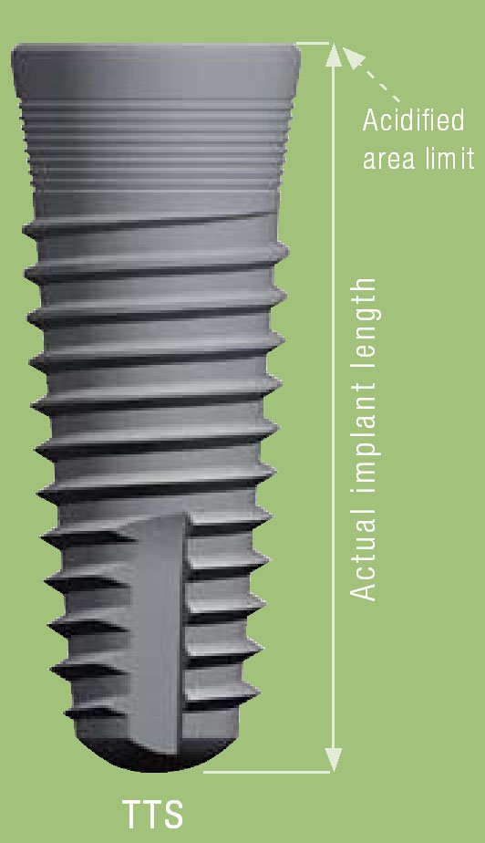 Leader Italia Tapered Implus Internal Hex Narrow Thread Dental Implant ...