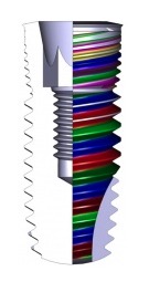 Medical Production i-Cone (ICC) Dental Implant | SpotImplant