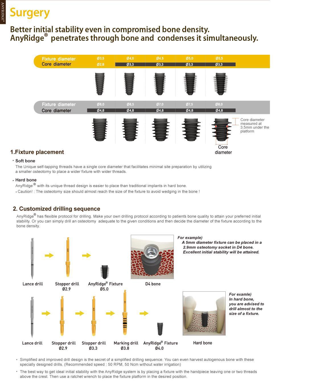 Megagen Anyridge Implante dental | SpotImplant