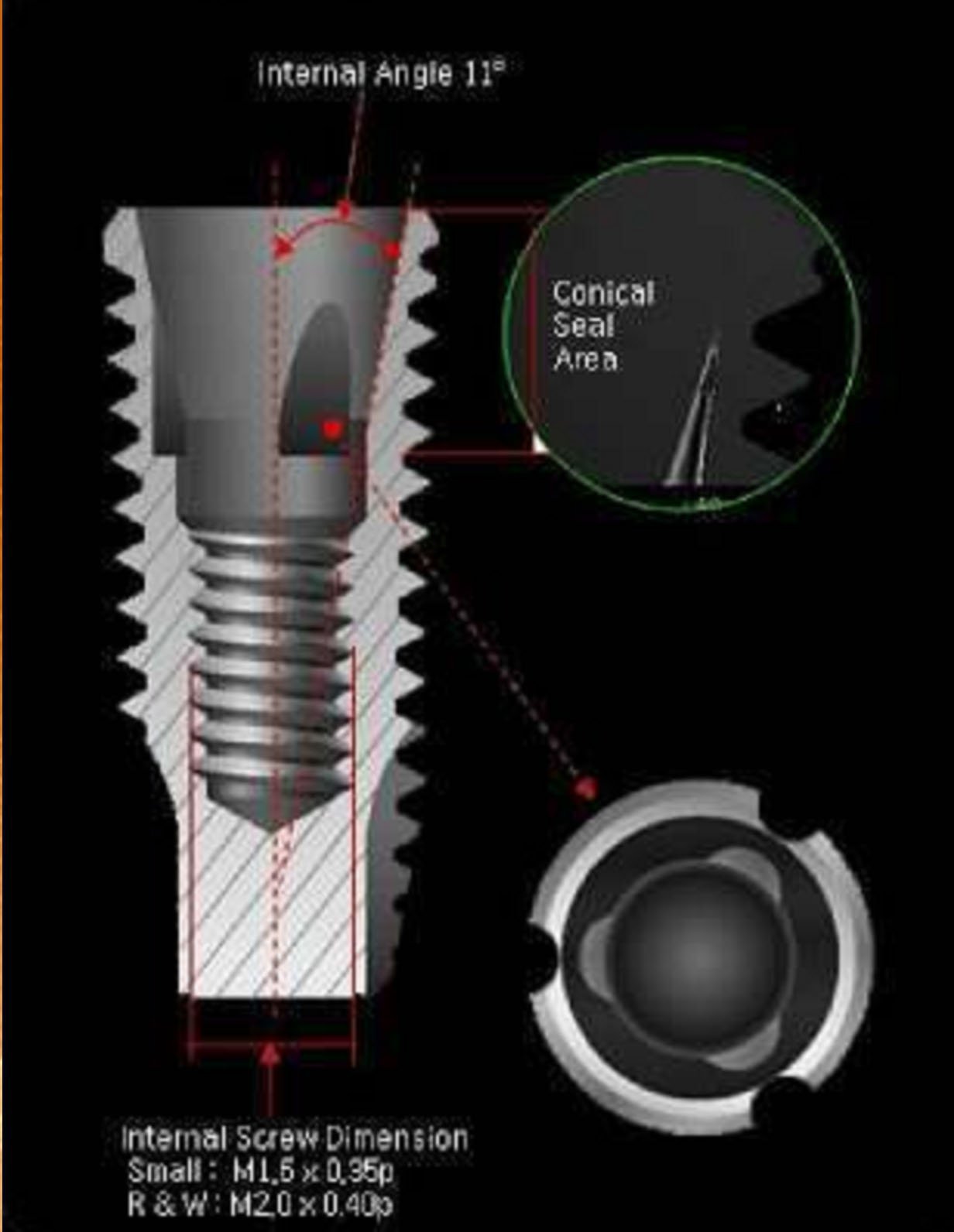 Megagen EZ Plus Implant dentaire | SpotImplant