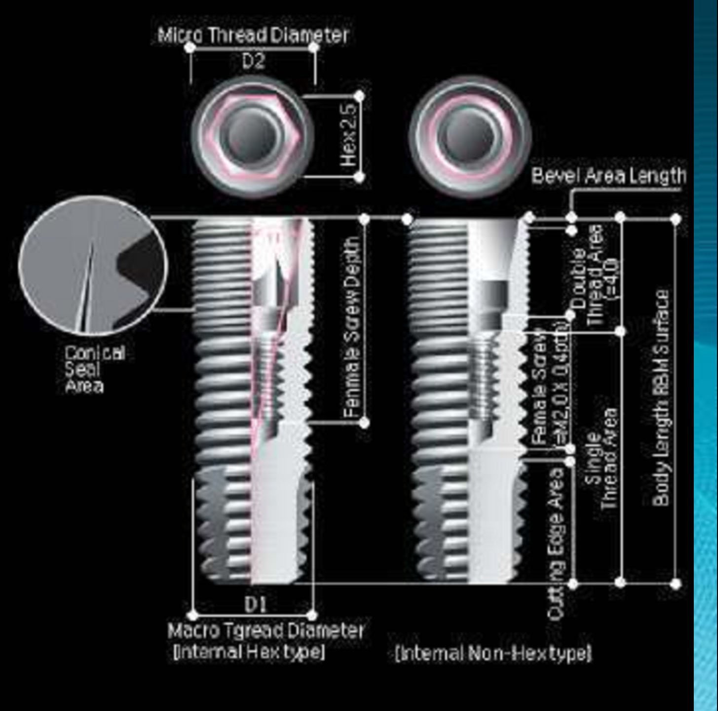 Megagen MegaFix Hex Type Dental Implant | SpotImplant