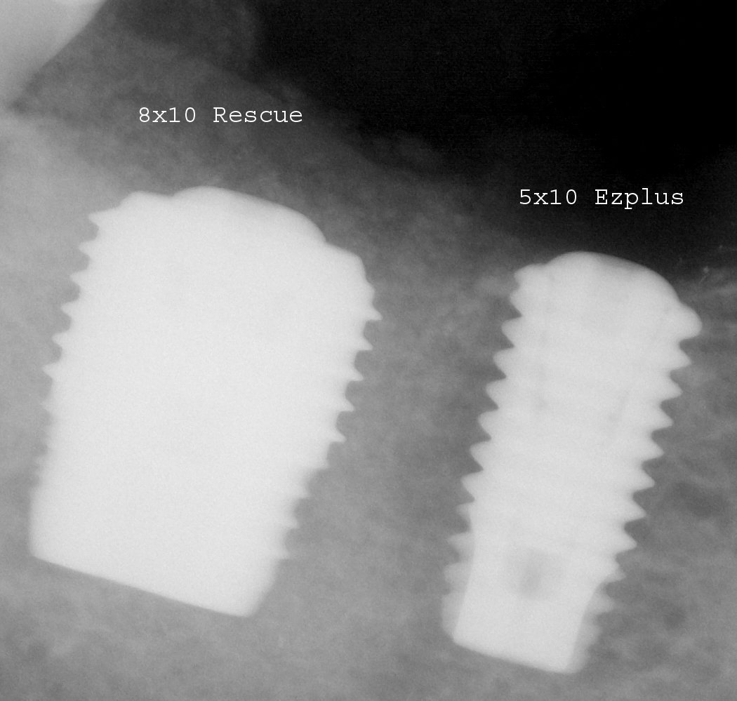 Megagen Rescue Internal Dental Implant | SpotImplant