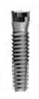 Microtech Minivent Implante dental | SpotImplant