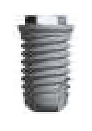 Nobel Biocare Branemark System MK III TiUnite Implant dentaire ...