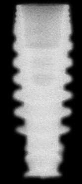 Nobel Biocare NobelActive Implante dental | SpotImplant