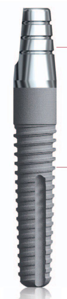 Nobel Biocare NobelDirect 3.0 Implant dentaire | SpotImplant