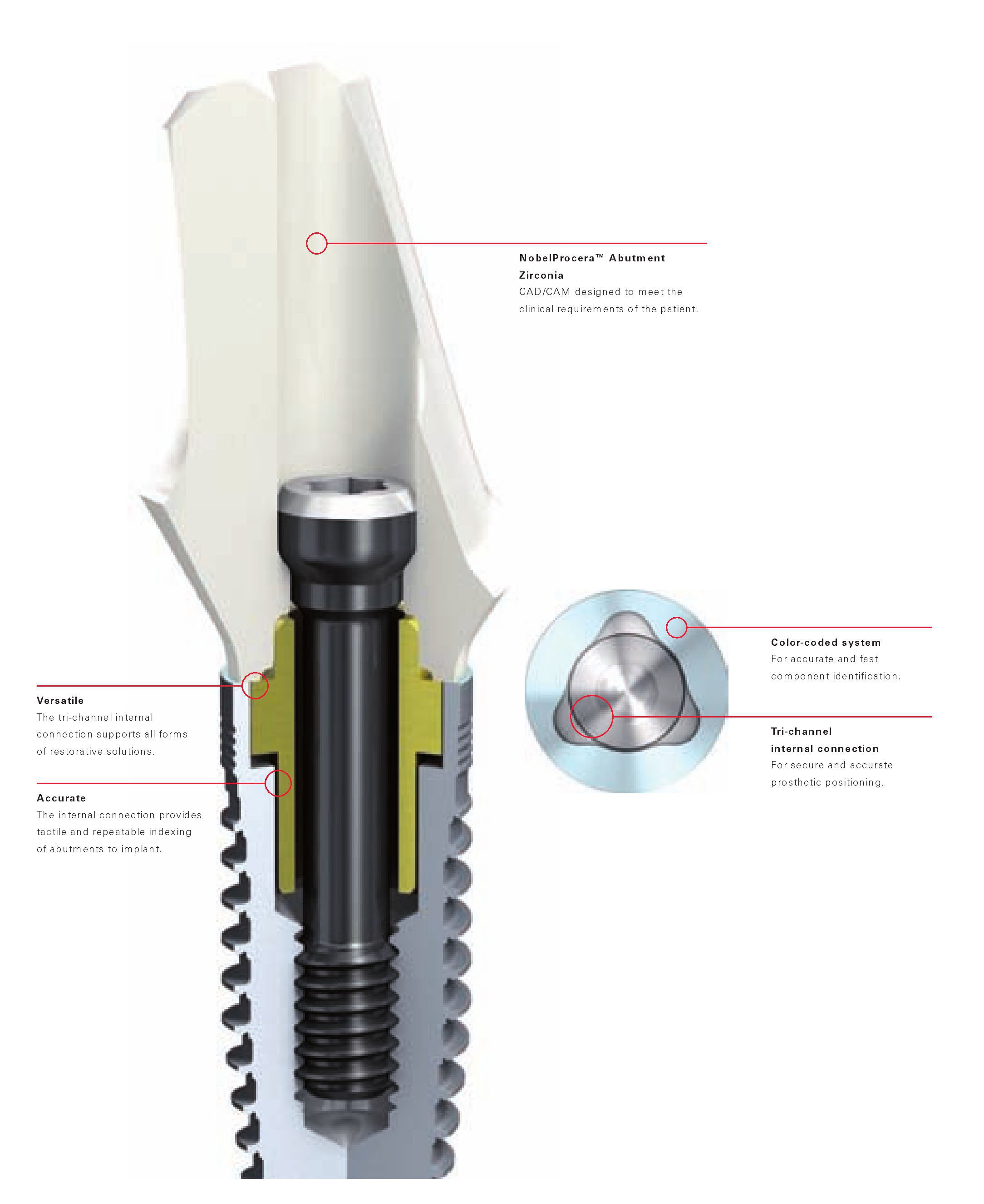 Nobel Biocare NobelReplace Tapered Impianto dentale | SpotImplant