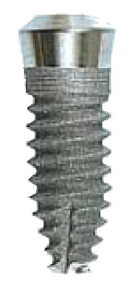 OCO Biomedical TSI Dental Implant | SpotImplant