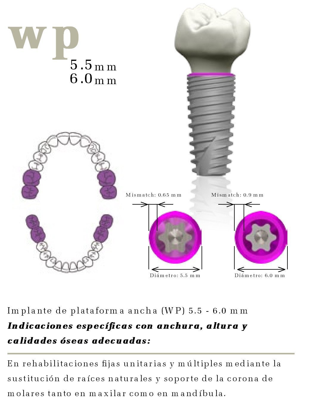 Phibo Aurea Implante dental | SpotImplant