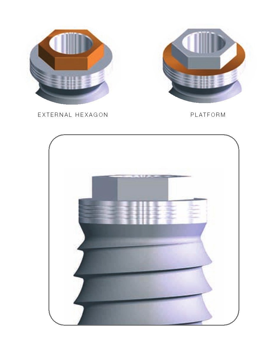 Phibo TSH Dental Implant | SpotImplant