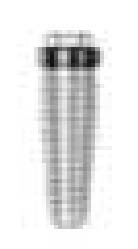 Renew Biocare Re-Root Dental Implant | SpotImplant