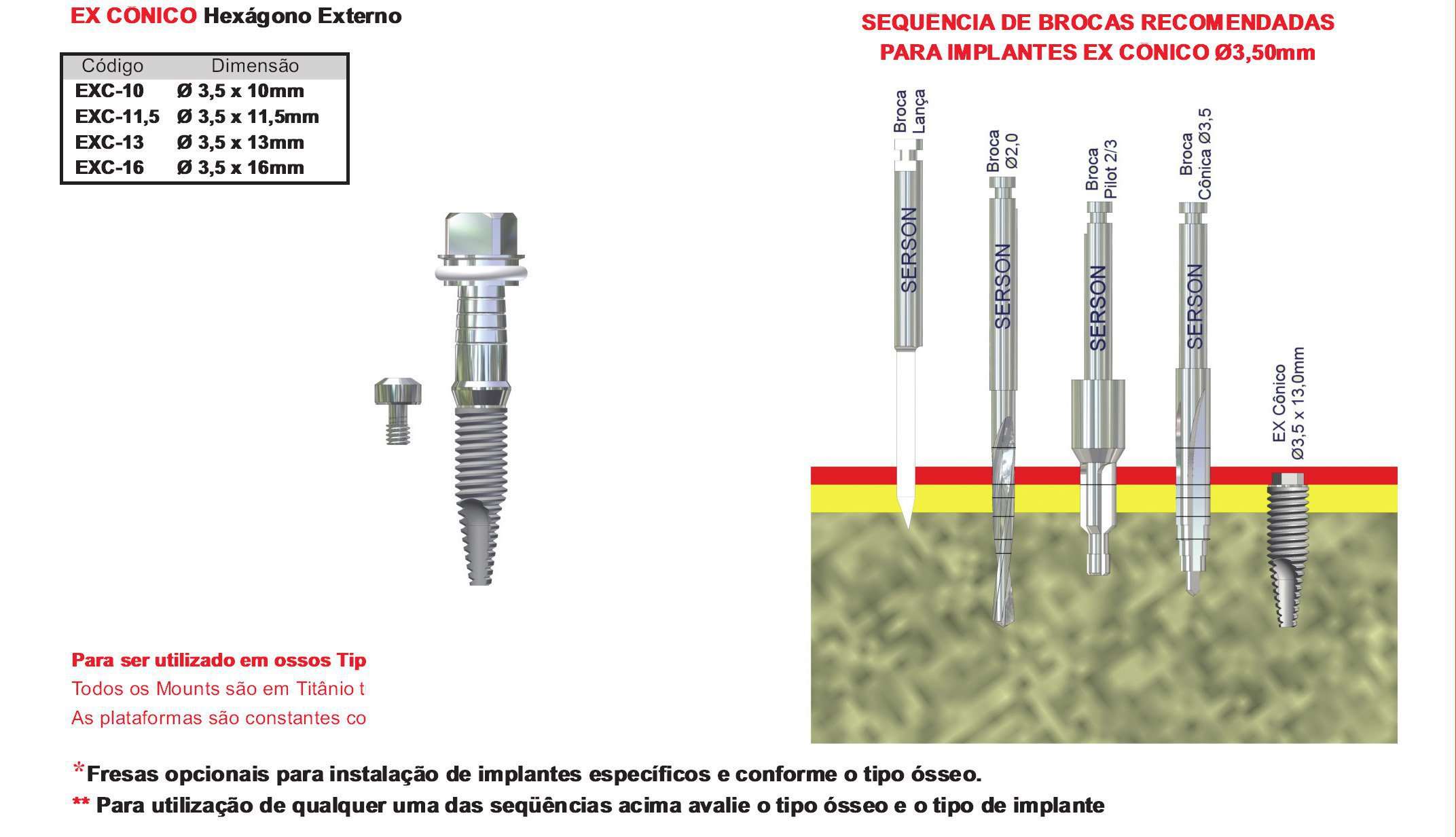 Serson Implant Ex Conico Dental Implant | SpotImplant