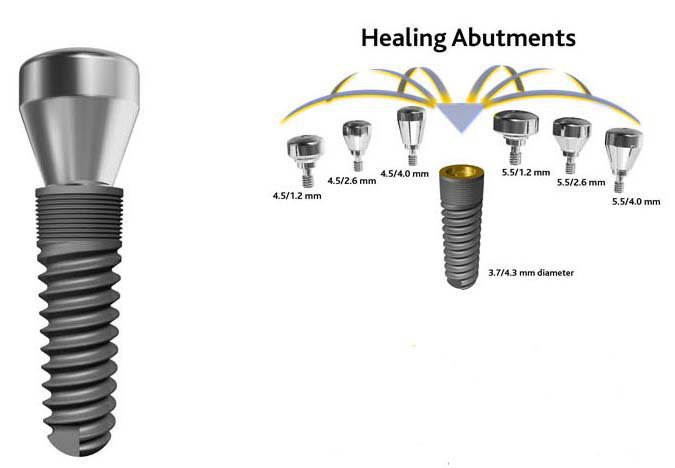 Simpact Simpact Dental Implant | SpotImplant