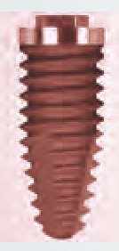 S.I.N Implant System (SIN) Tryon CO Implante dental | SpotImplant