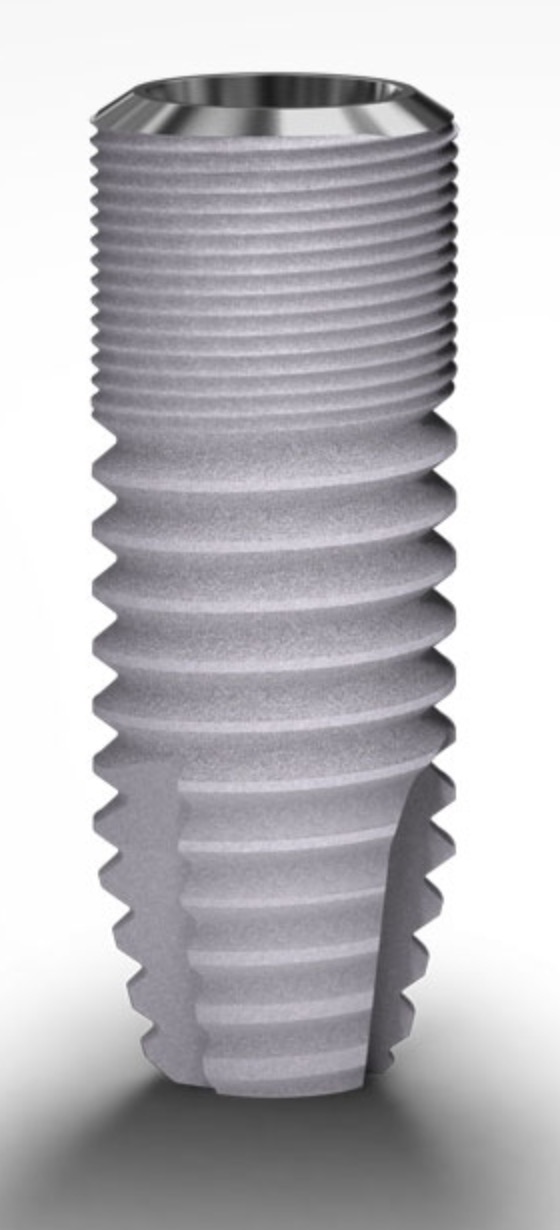 Titanium Fix b-fix Black-Fix Implant dentaire | SpotImplant