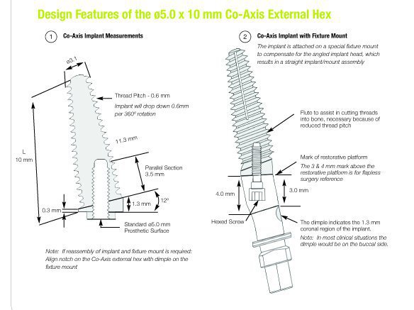 Southern Implants External Hex Co-Axis 12d Dental Implant | SpotImplant