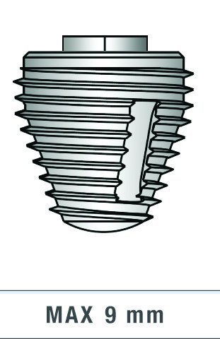 Southern Implants External Hex Max Dental Implant | SpotImplant