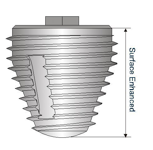 Southern Implants External Hex Max Implant dentaire | SpotImplant