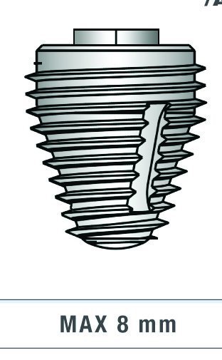 Southern Implants External Hex Max Dental Implant | SpotImplant